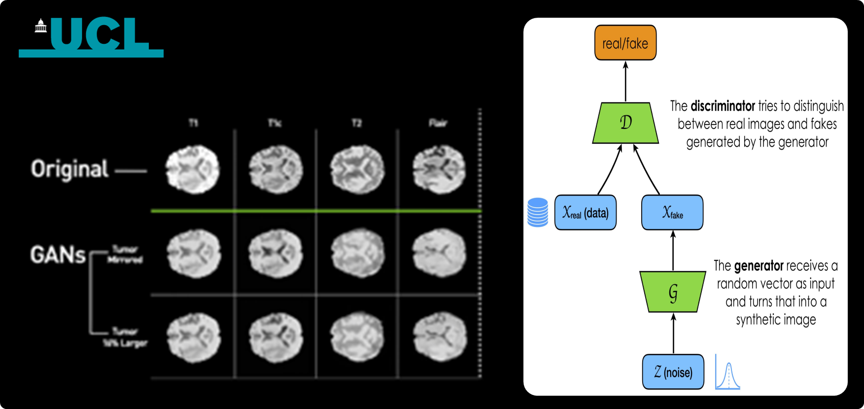 More data for rare disease detection — Case Study — Zero2AI